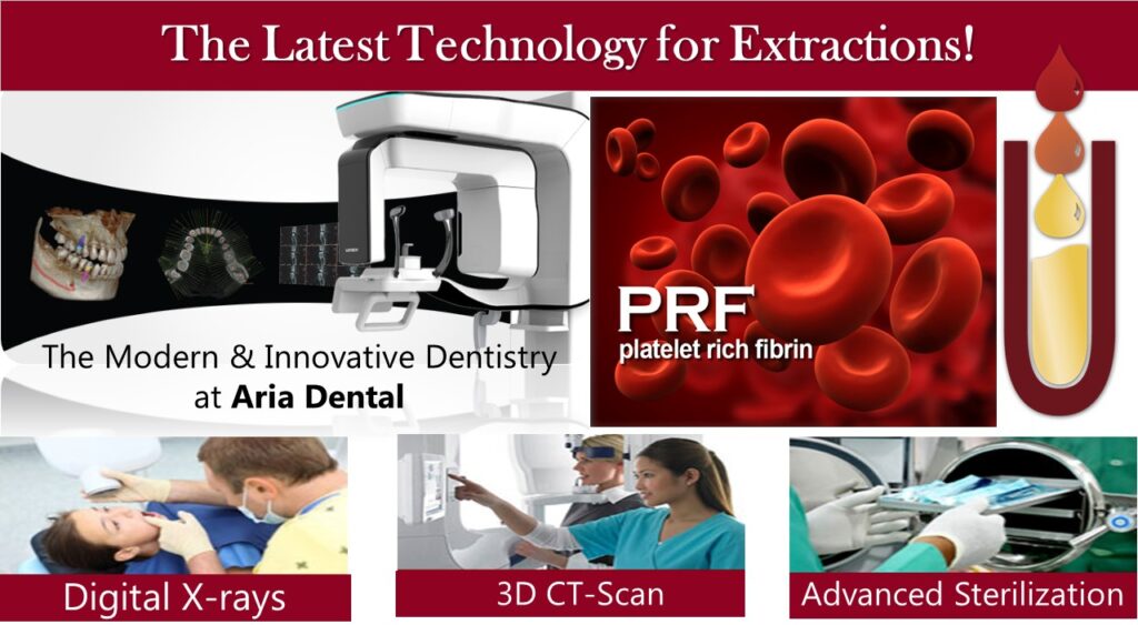 Wisdom Teeth Extractions | Aria Dental