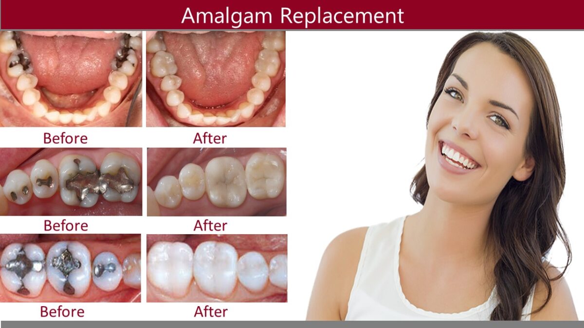 Smile Gallery | Aria Dental