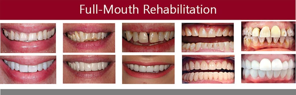 Smile Gallery | Aria Dental