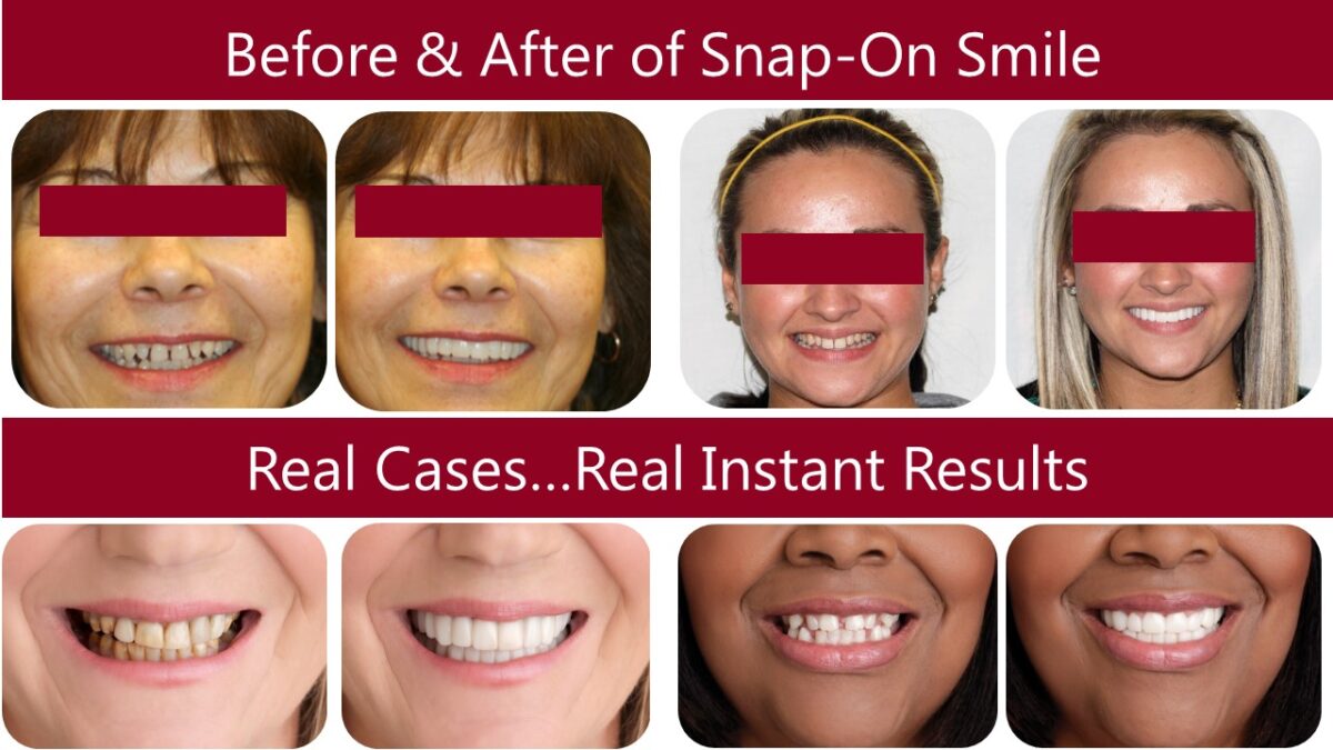 Smile Gallery | Aria Dental