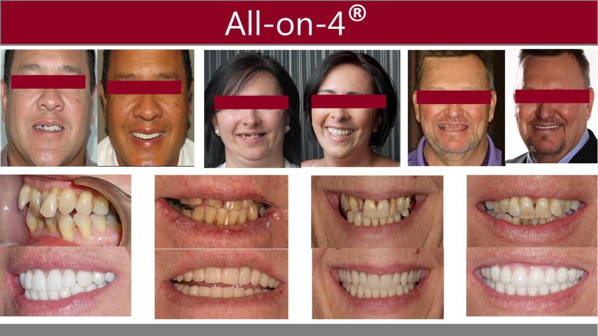 Smile Gallery | Aria Dental