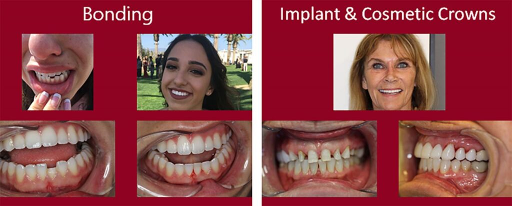 Smile Gallery | Aria Dental