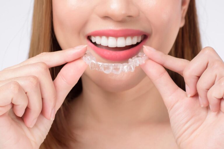 Full Invisalign Process Step by Step | Aria Dental