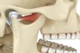 TMJ Face Distortion: The Ugly Side of a Disorder | Aria Dental Care