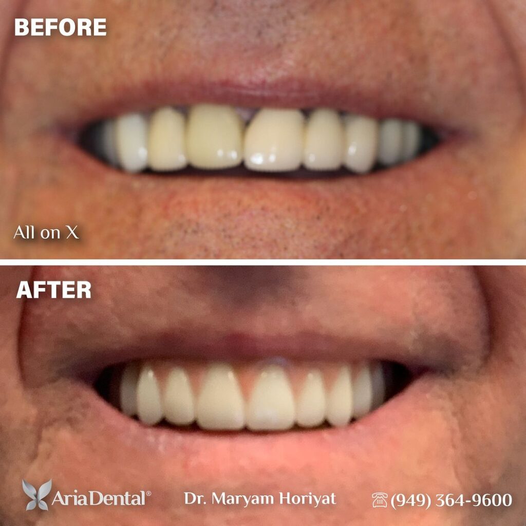Smile Gallery | Aria Dental